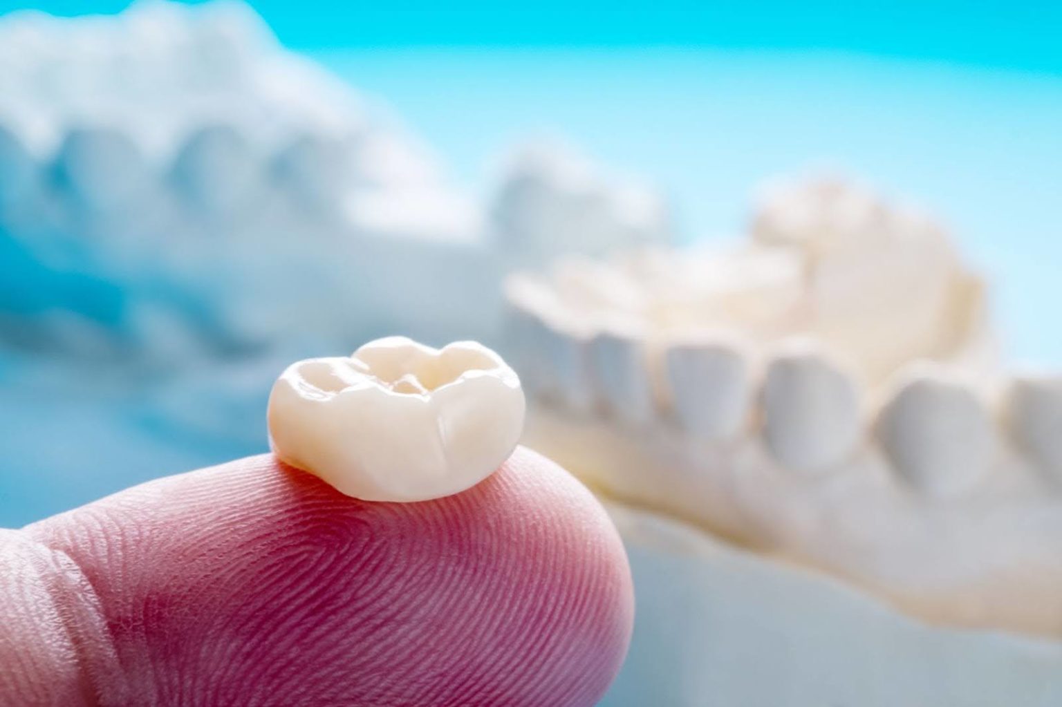 Comprehensive Guide To Full Mouth Dental Crowns